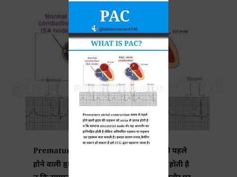What is PAC|PAC|PAC full form|Premature Atrial Contraction|Heart|atria|sinoatrial node|ECG#ecg#heart