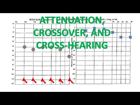 Chapter 6: Crossover and Cross-Hearing Videos – The Masking Handbook ...
