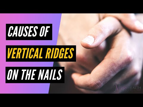 The Causes of Vertical Ridges on Nails