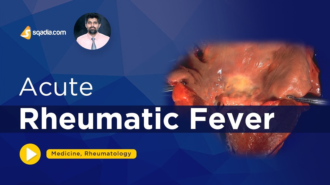 Acute Rheumatic Fever | Rheumatology Video Lectures | Medical Student | Trailer