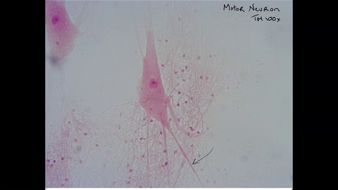 Motor Neuron Slide