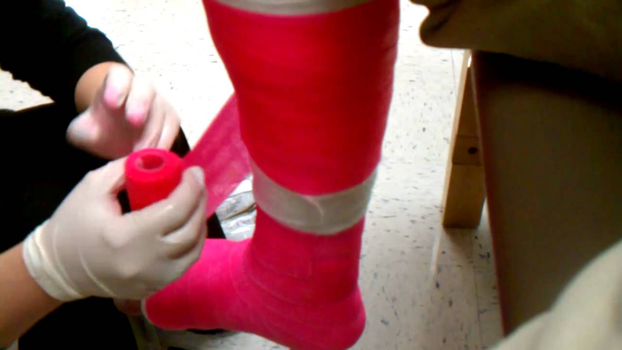 Pink cast application