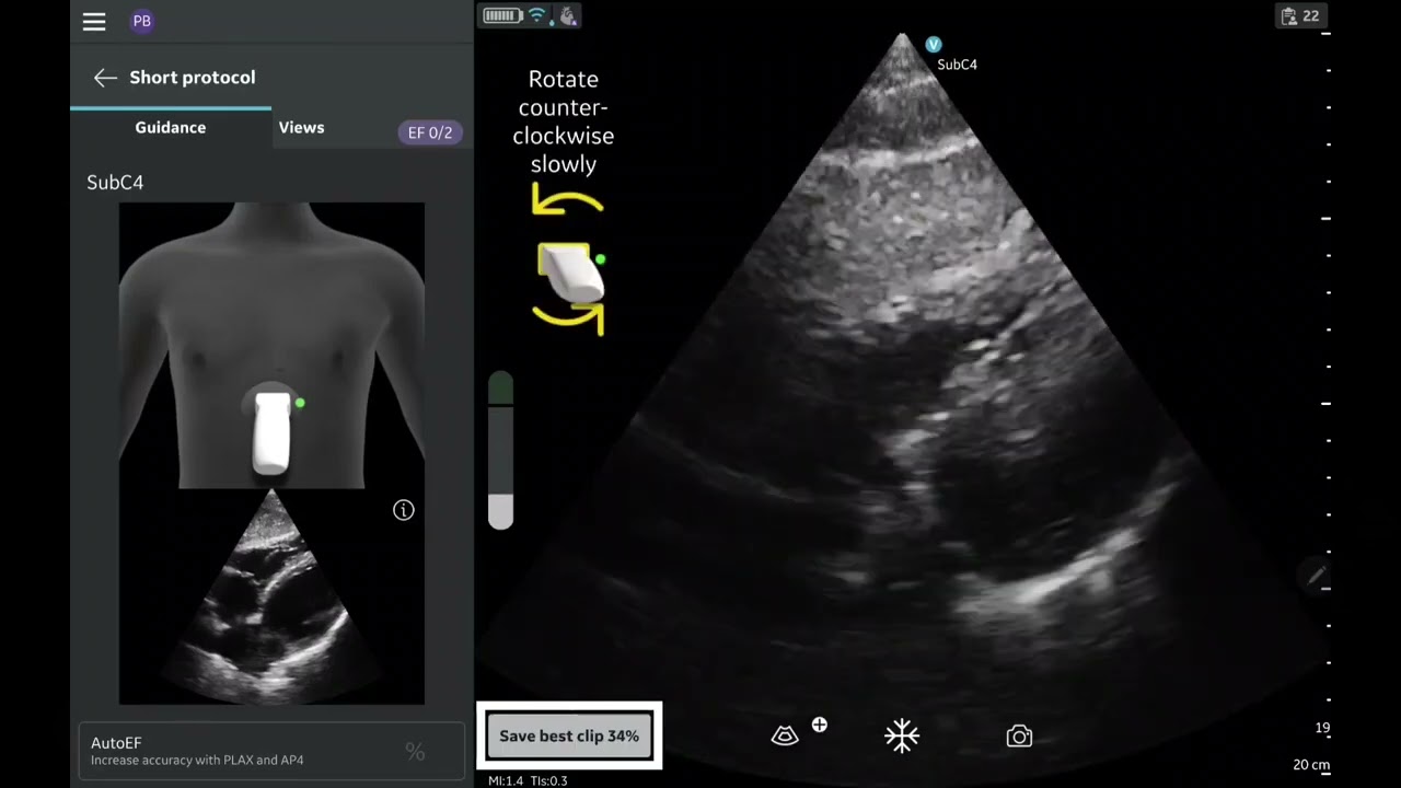 Vscan Air™ Product Tutorial | Caption AI™
