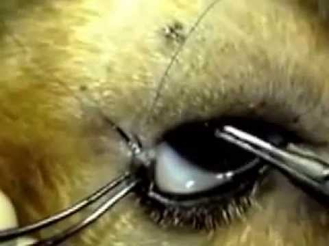Lateral Canthoplasty Cadaver