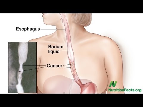 Strawberries versus Esophageal Cancer