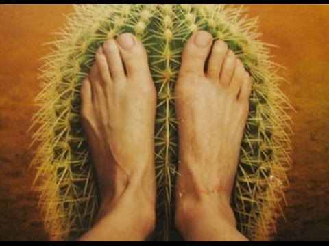 What is Diabetic Peripheral Nueropathy?