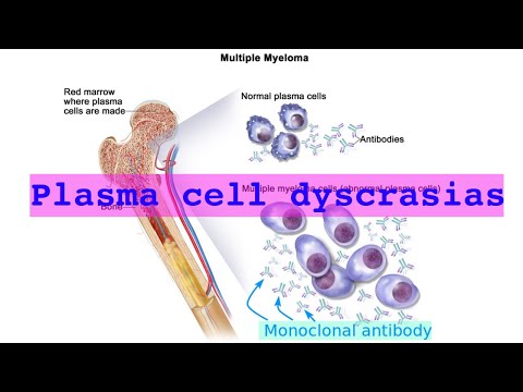 plasma cell dyscrasias