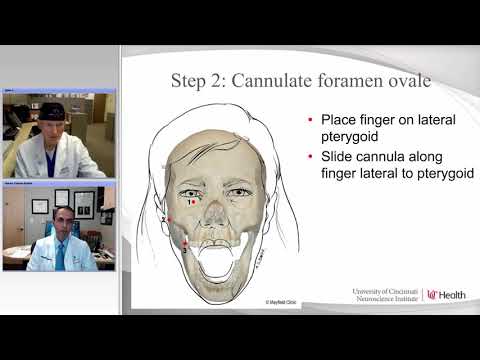 Percutaneous Procedures for Trigeminal Neuralgia Radiofrequency and Balloon Compression Rhizotomy