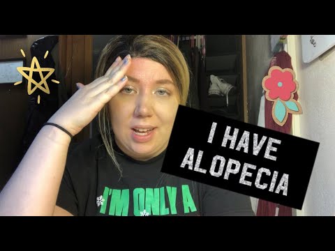 I have alopecia