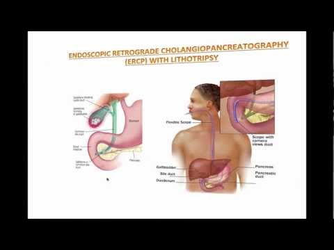 Lesson 8 - Root Operation: Fragmentation - Homework Review