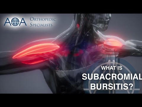 AOA Orthopedic Specialists - Subacromial Bursitis