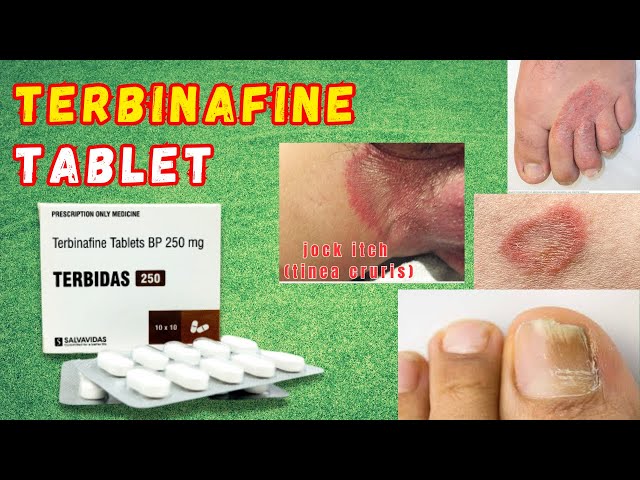 Anti Fungal Medicines - Famciclovir 500 Mg Tablets Manufacturer from Nagpur