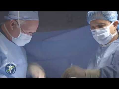 Sports Hernia Specialist, Dr. William H. Brown