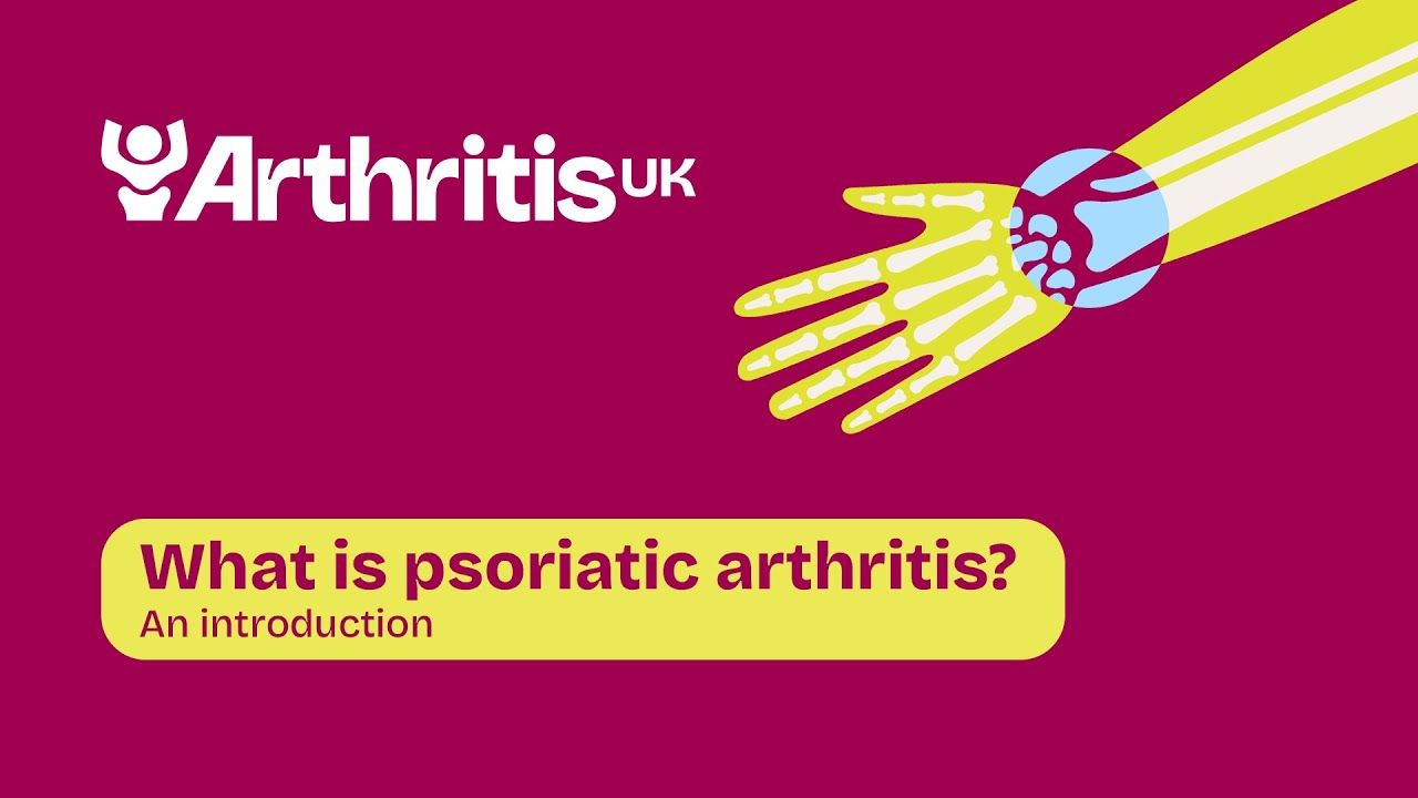 What is psoriatic arthritis?