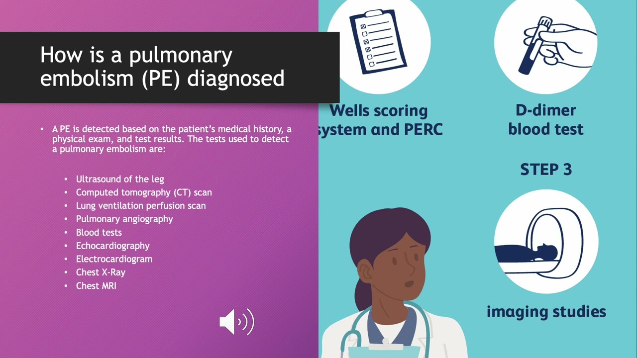 Pulmonary Embolism Powerpoint