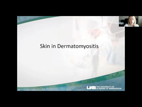 Myositis and the Skin