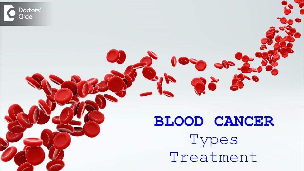 Blood Cancer | Types, Latest Treatment Plan, Life Expectancy - Dr.Mangesh P Kamath | Doctors' Circle