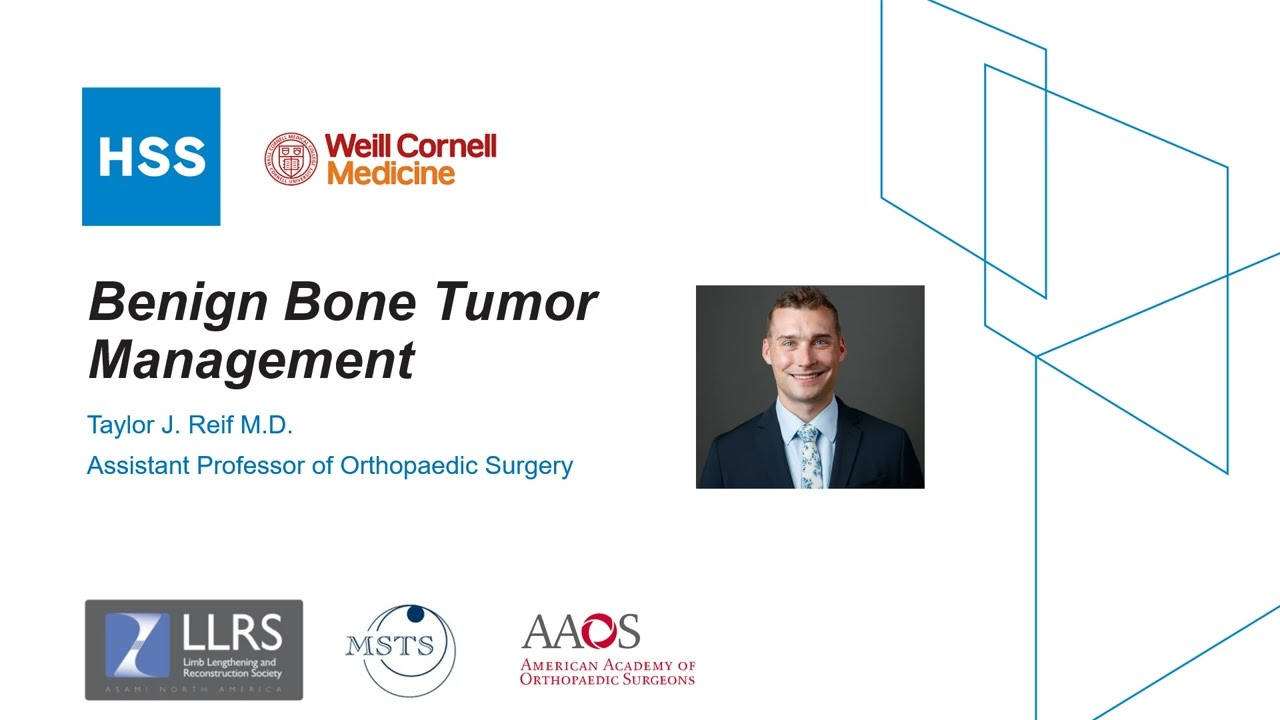 Benign Bone Tumor Management