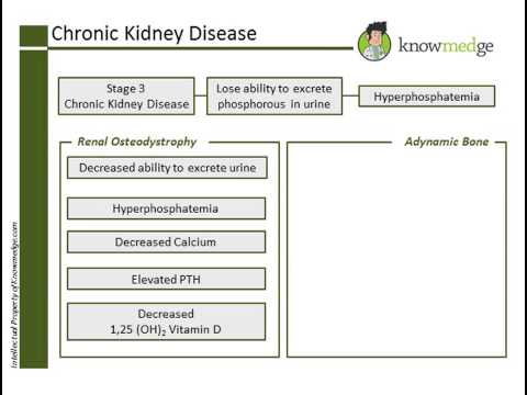 Internal Medicine ABIM Board Exam Review Question: Chronic Kidney Disease