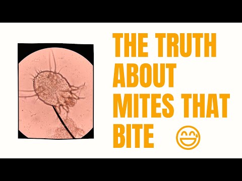 The Truth About Mites that Bite: With Examples