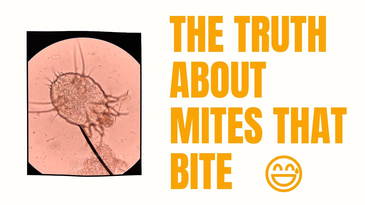 The Truth About Mites that Bite: With Examples