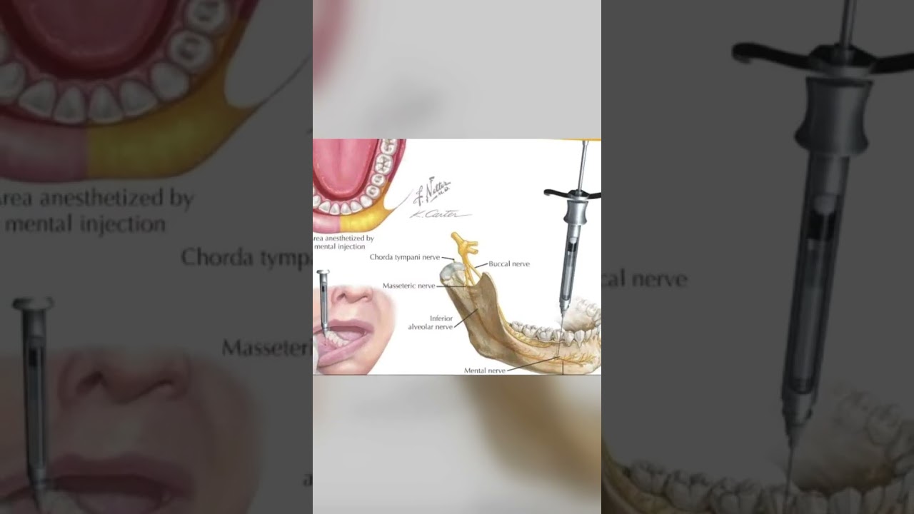 Dental Laboratory#shorts
