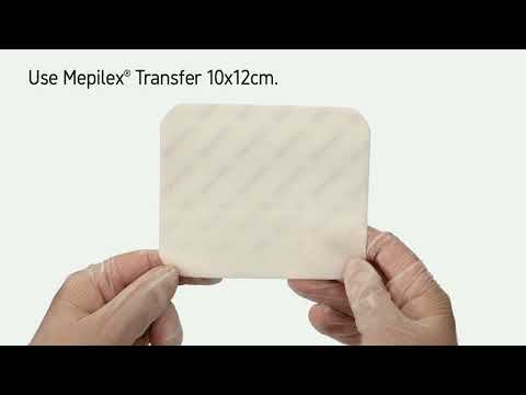 How to apply Mepilex Transfer to heel and elbow
