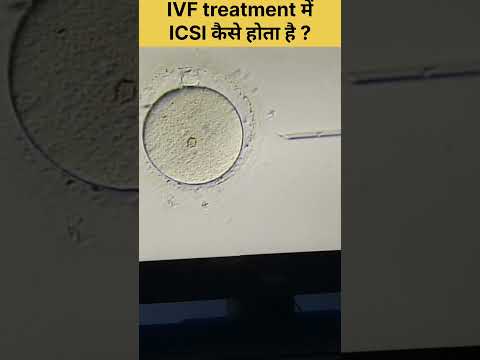 ICSI Procedure in IVF, Intracytoplasmic sperm injection #fertilitytreatment #ivfjourney #ivfsuccess