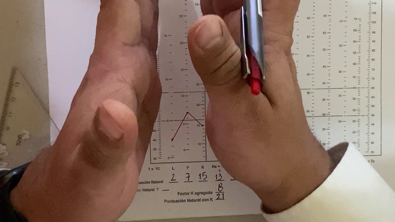 calificacion y analisis MMPI 2