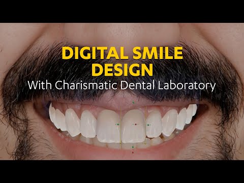 Digital Smile Design with Charismatic Dental Laboratory