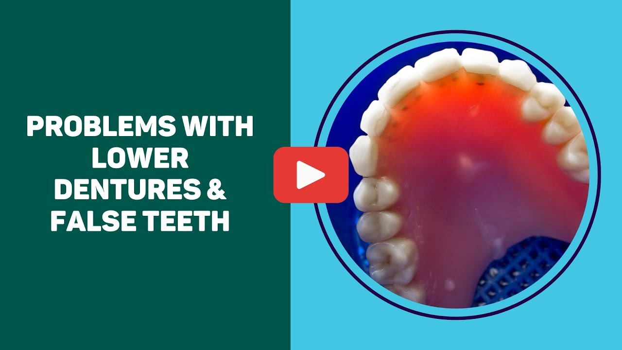 Problems with Lower Dentures & False Teeth