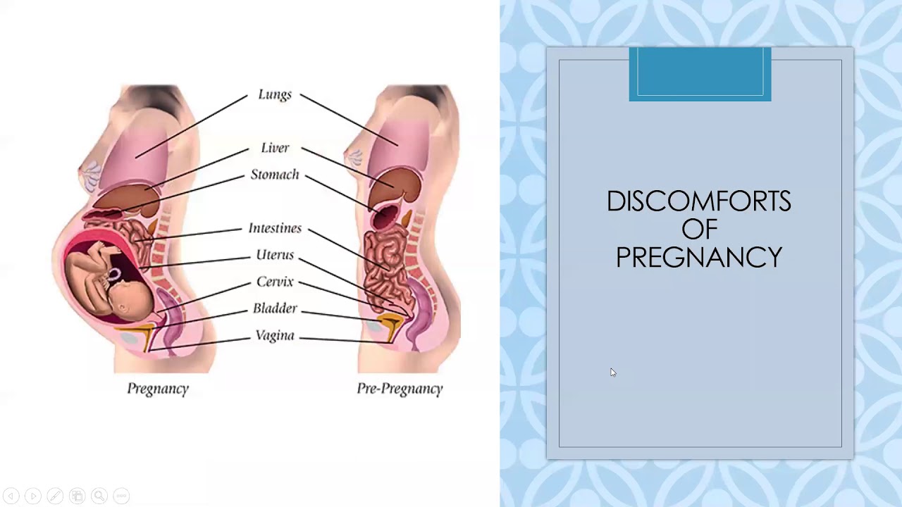 Ricci Ch 11 Maternal Adaptations During Pregnancy S20