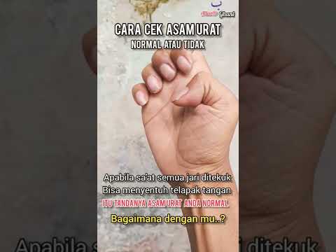 cara sederhana cek asam urat normal atau tidak