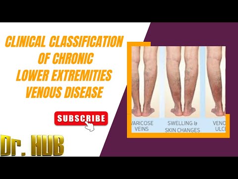 Exam High Yield: Clinical Classification of Chronic Lower Extremities ...