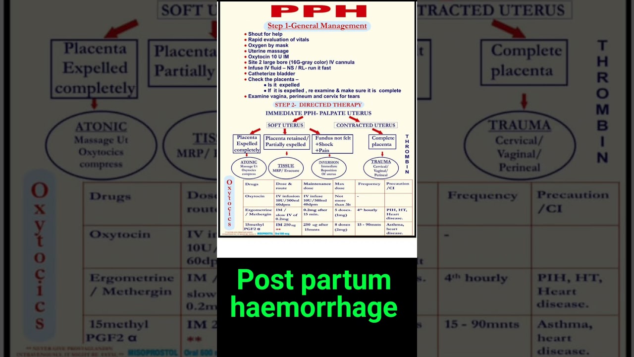 Post partum haemorrhage (PPH) # general management flow chart # PPH management # bleeding#  delivery