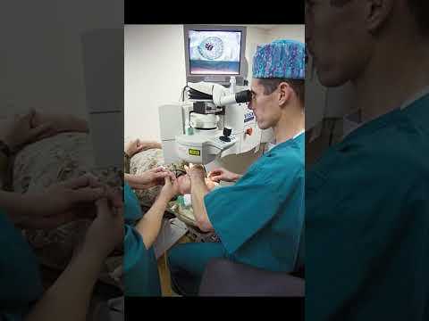 Is it safe to get LASIK with pigment dispersion syndrome?