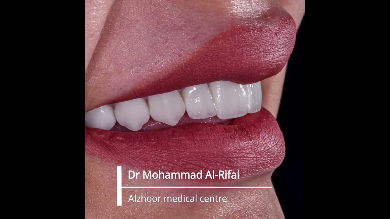 Dr. Mohammad Al Rifai – Al Ain, UAE