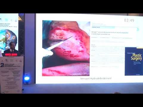 Session5 Kasr Alaini Burn Unit