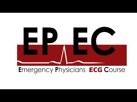 #EPEC ECG Cases (Case 44), Have you ever heard about the Bix rule?