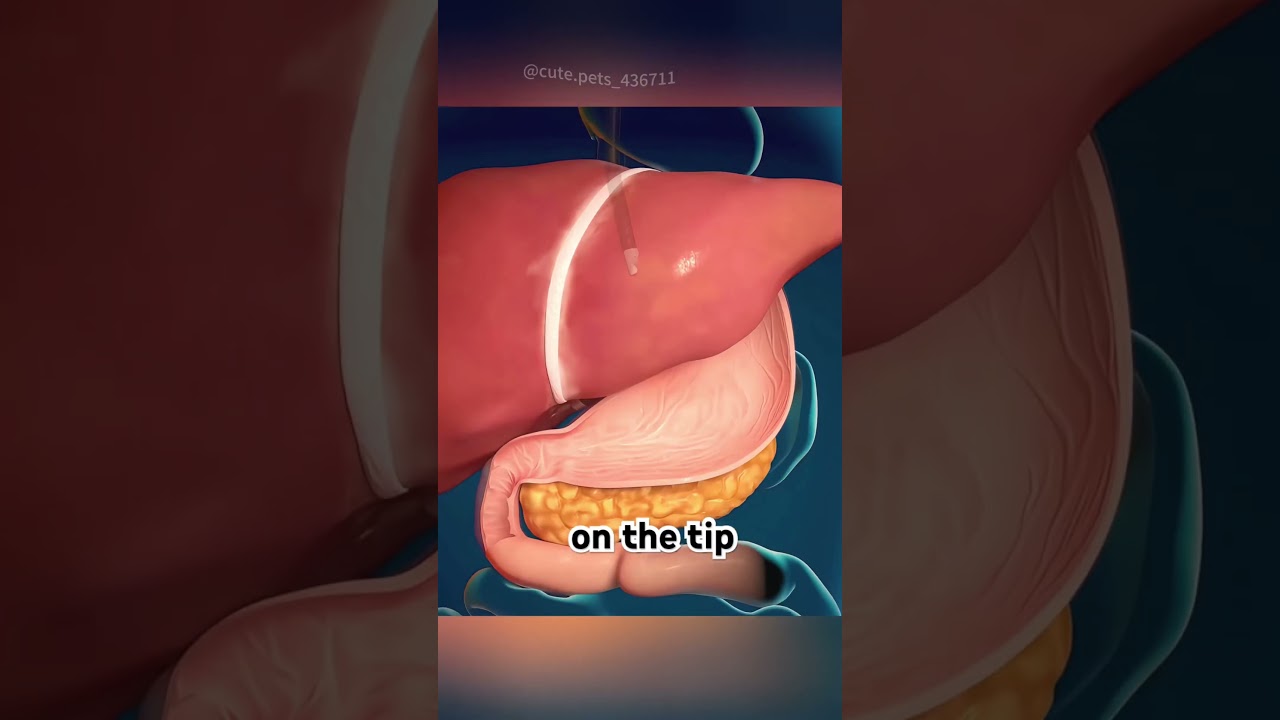 Gastroscopy Procedure(3D Animation) #gastroscopy #endoscopy #medical3d #medicalanimation
