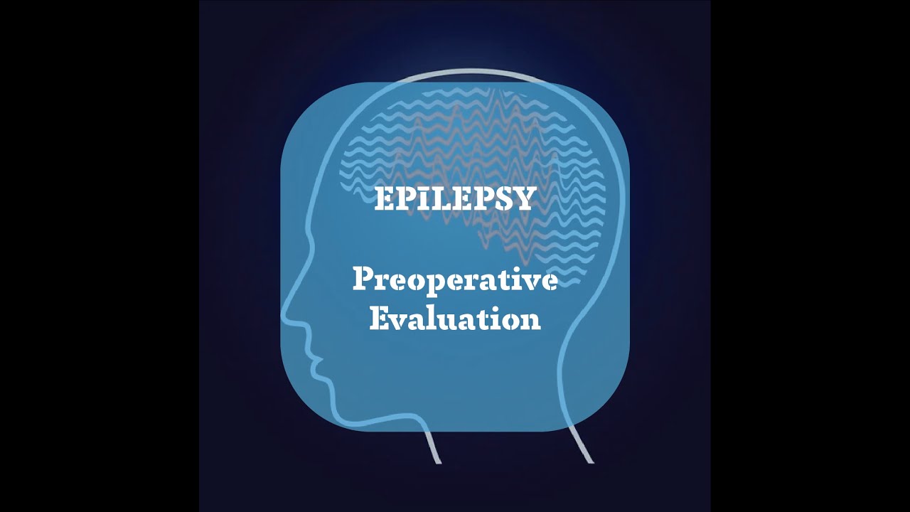 Neurosurgery Basics Lecture : Epilepsy - Preoperative evaluation