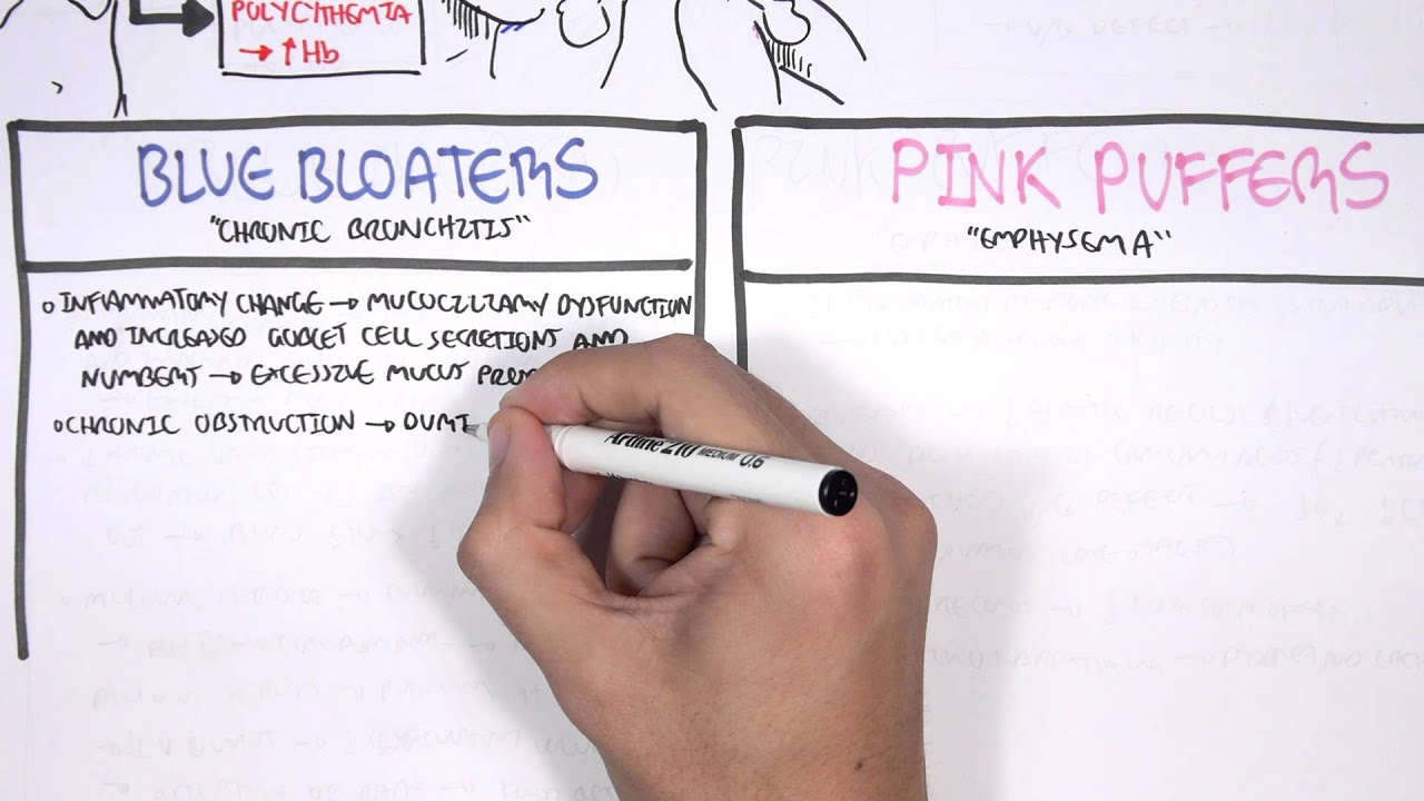 COPD - Overview and Pathophysiology (PART I)