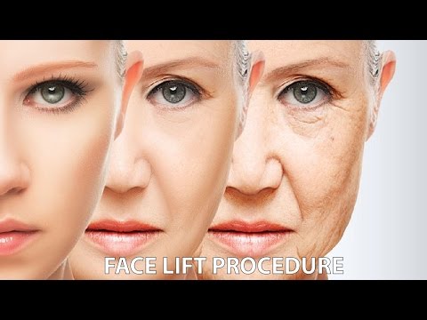 Magic by Dr. Stile - Facelift Procedure