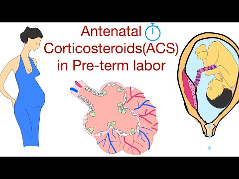 Antenatal corticosteroid use in pre-term labor/Dexamethasone or Betamethasone injection in pregnancy