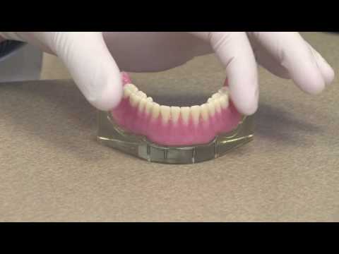 Why are you still wearing a lower denture? | orthoimplant