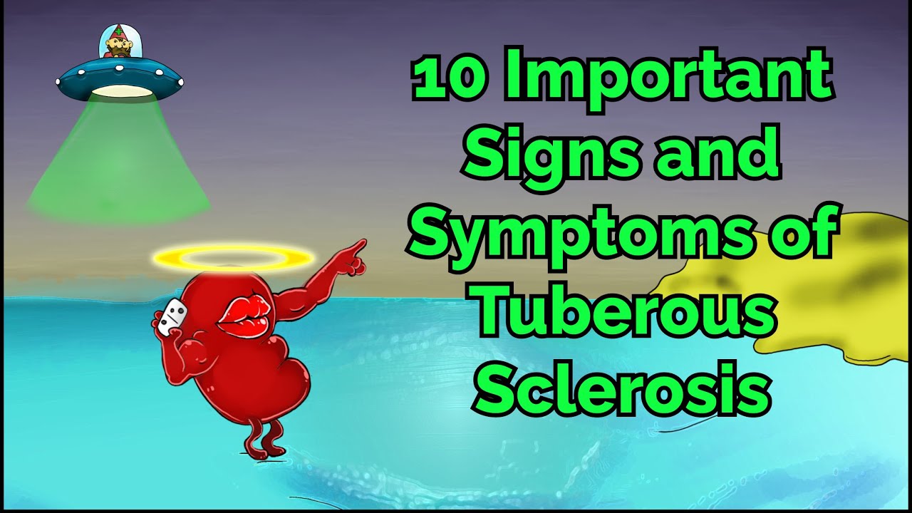 10 Important Signs and Symptoms of Tuberous Sclerosis (Step 1, COMLEX, NCLEX®, PANCE, AANP)