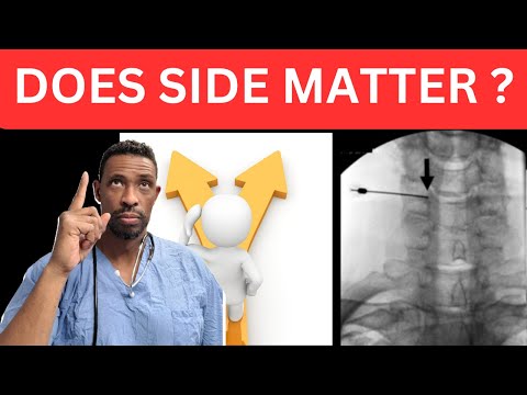 Right or Left Stellate Ganglion Blockade for PTSD: Does Side Matter? Best Solution for you!