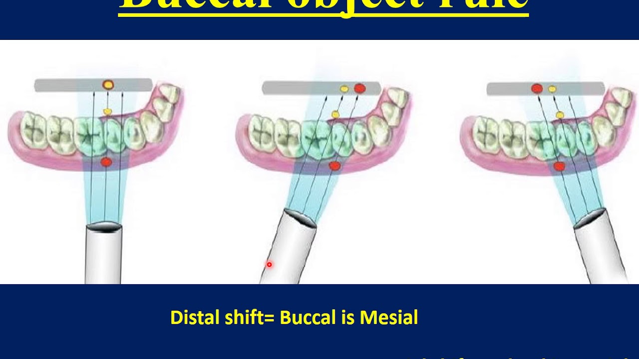 Digital radiography in endodontics
