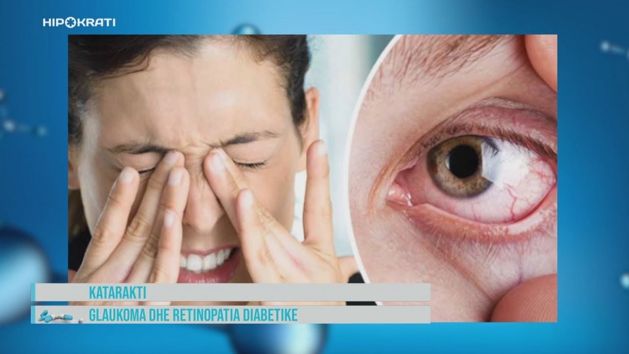 Hipokrati – Retinopatia diabetike, paralajmëron mjekja! “Mund të shkojë ... Hipokrati – Retinopatia diabetike, paralajmëron mjekja! “Mund të shkojë ...