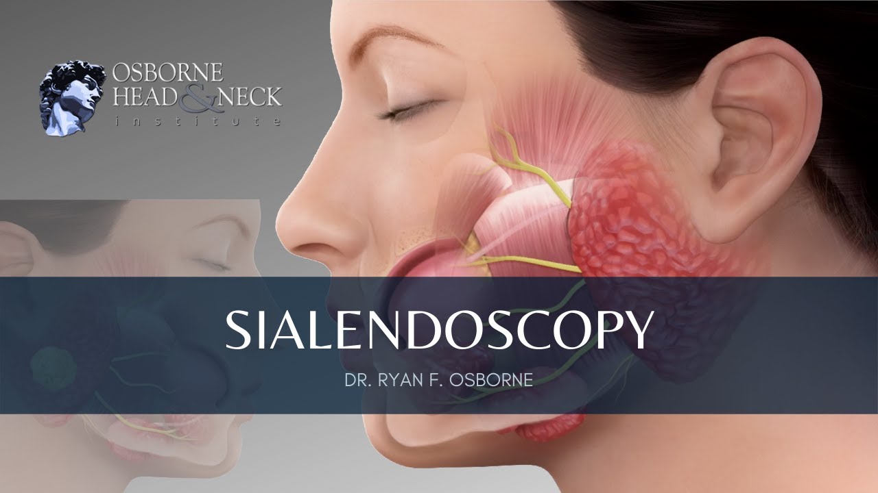 Sialendoscopy Procedure for Parotid Gland Stones, Explained By Dr. Ryan F. Osborne